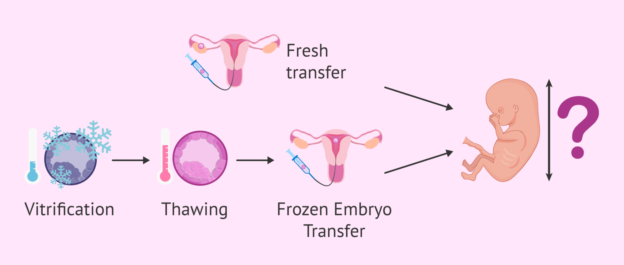 Fresh or deferred transfer and fetal growth