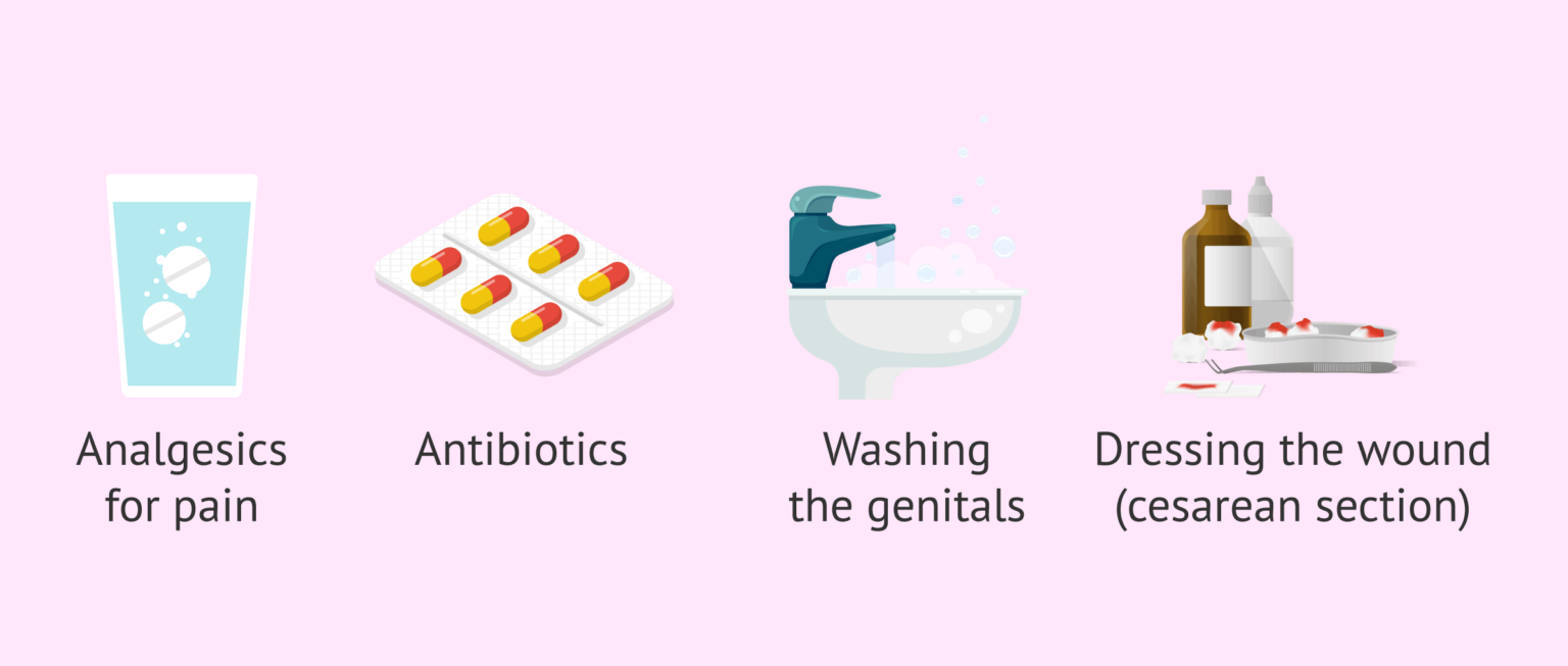 What is puerperal fever? - Symptoms, causes and treatment