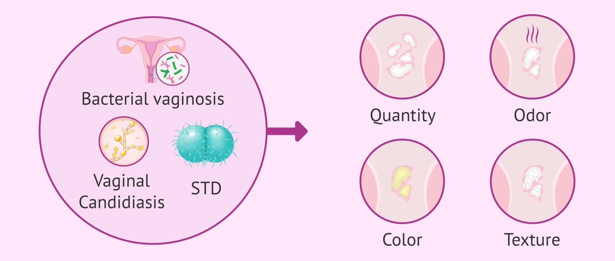 What causes changes in vaginal discharge?