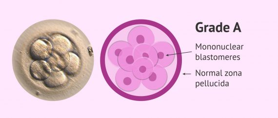 Embryo quality: grade A