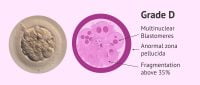 Embryo Grade D