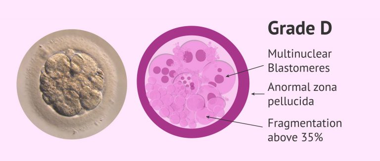 Embryo Quality & Grading - Does It Affect IVF Success?