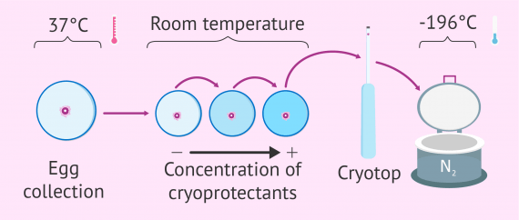 What is embryo vitrification? How and when is this procedure used?
