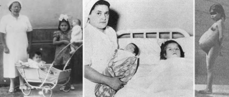 Unusual Human Births