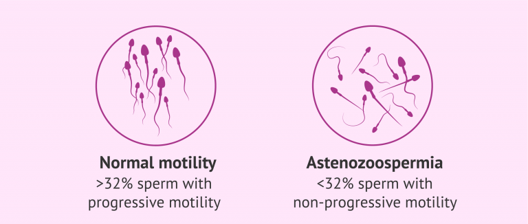 ICSI to treat asthenozoospermia or abnormal sperm motility