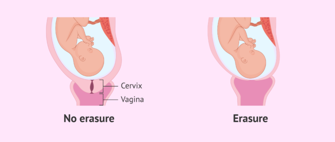 Ovulation Cervix Opening