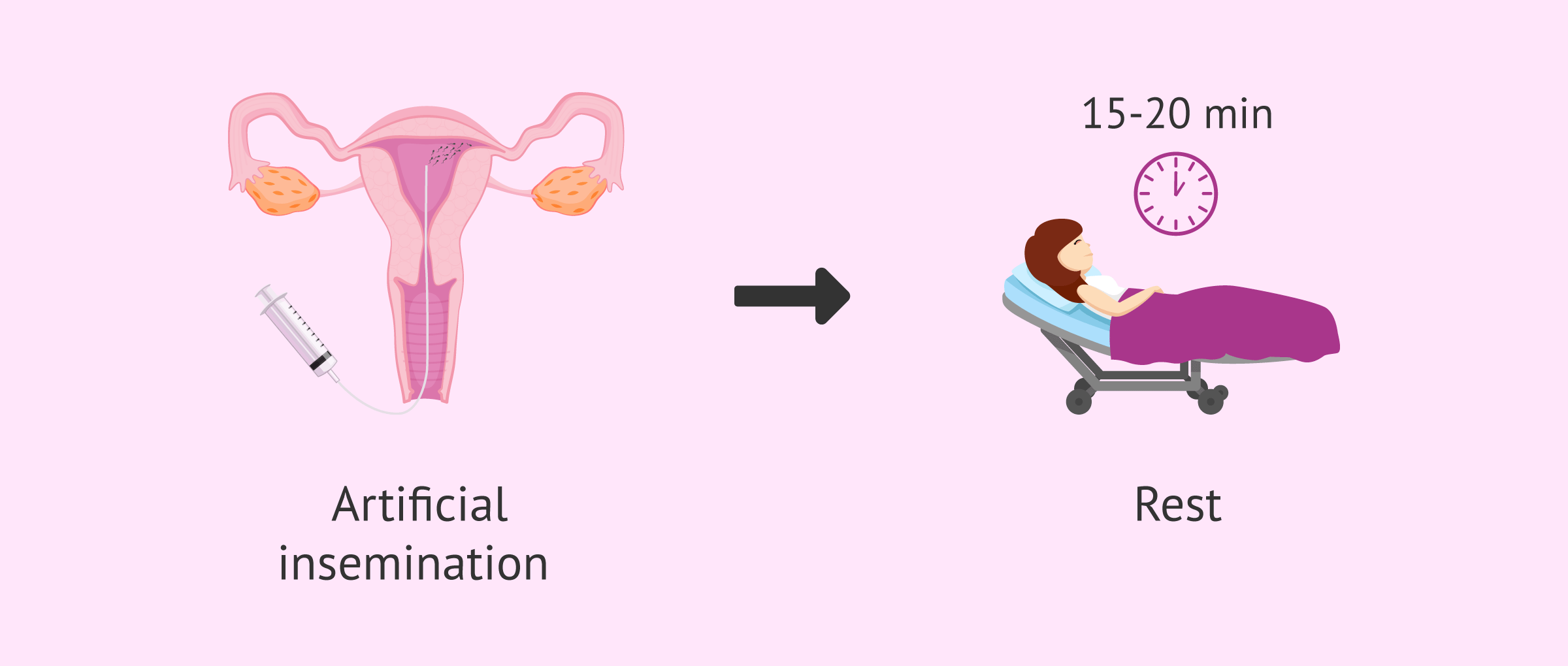 Rest After Artificial Insemination Rest After Artificial Insemination