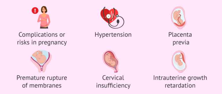 Contraindications to Pilates during pregnancy