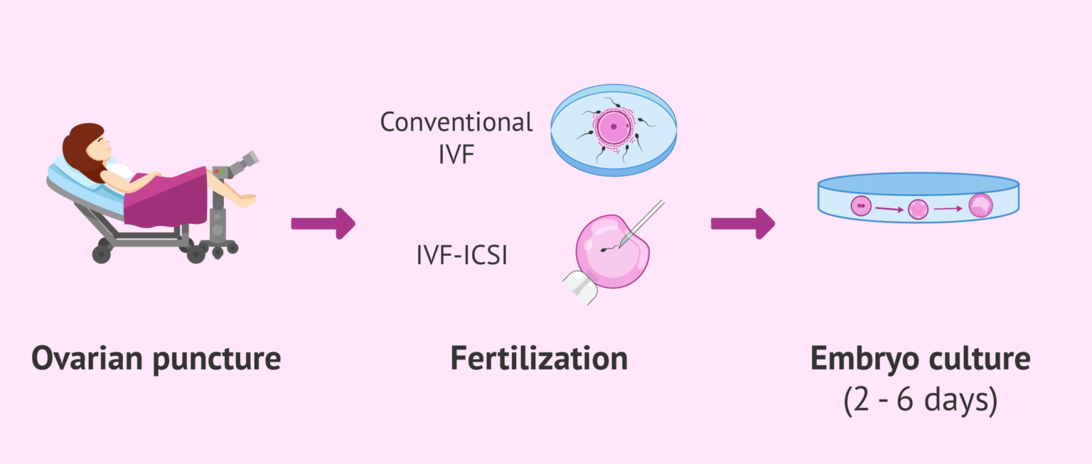 Embryo culture in the in vitro fertilization laboratory (IVF)
