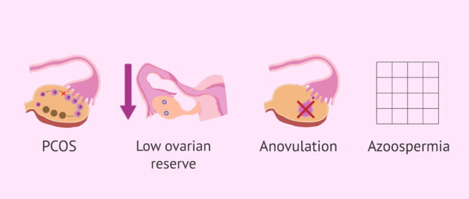 FSH hormone: what are its functions and normal values?
