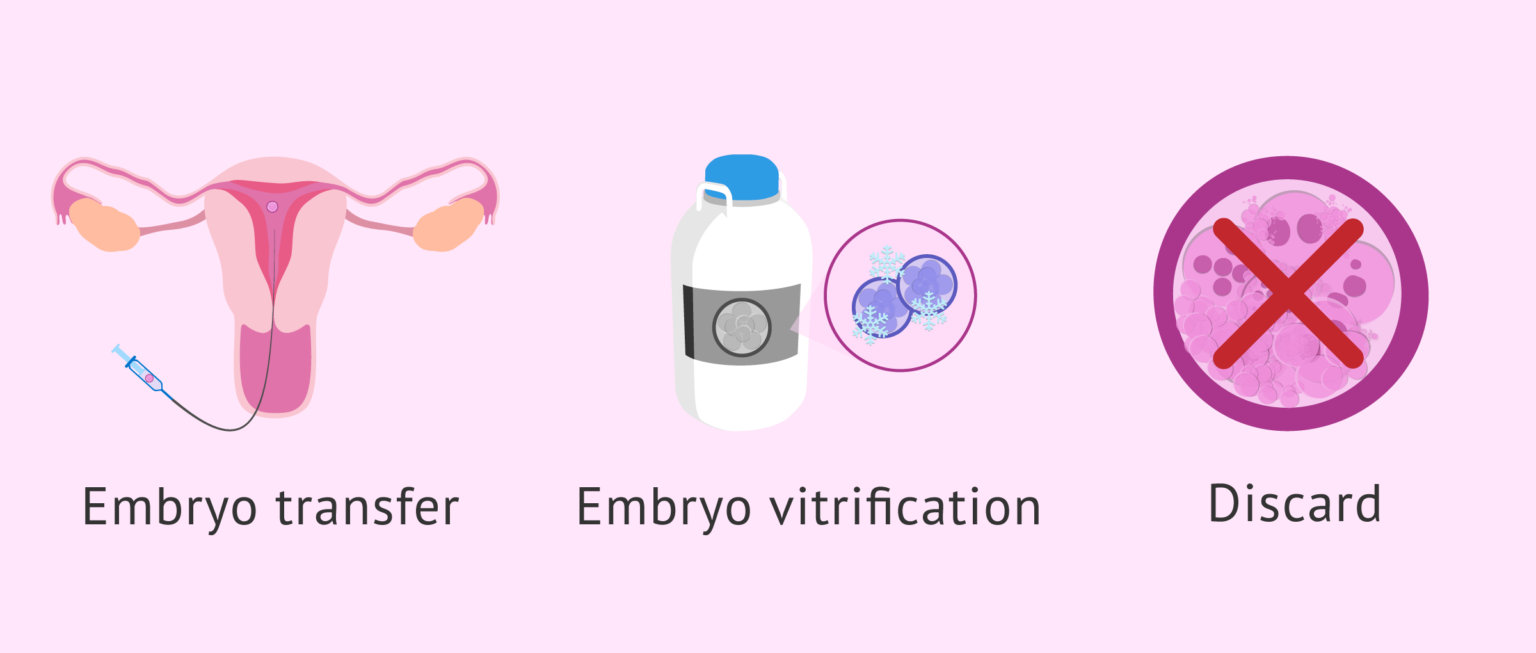 Embryo culture in the in vitro fertilization laboratory (IVF)