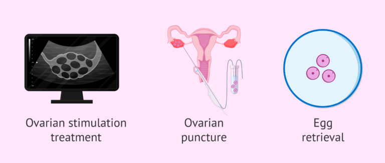 What is meant by egg vitrification and what are its advantages?