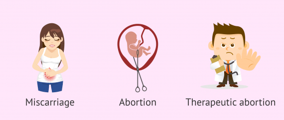 How many types of miscarriage are there and how do they differ?