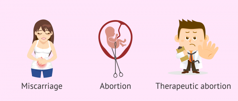 How many types of miscarriage are there and how do they differ?