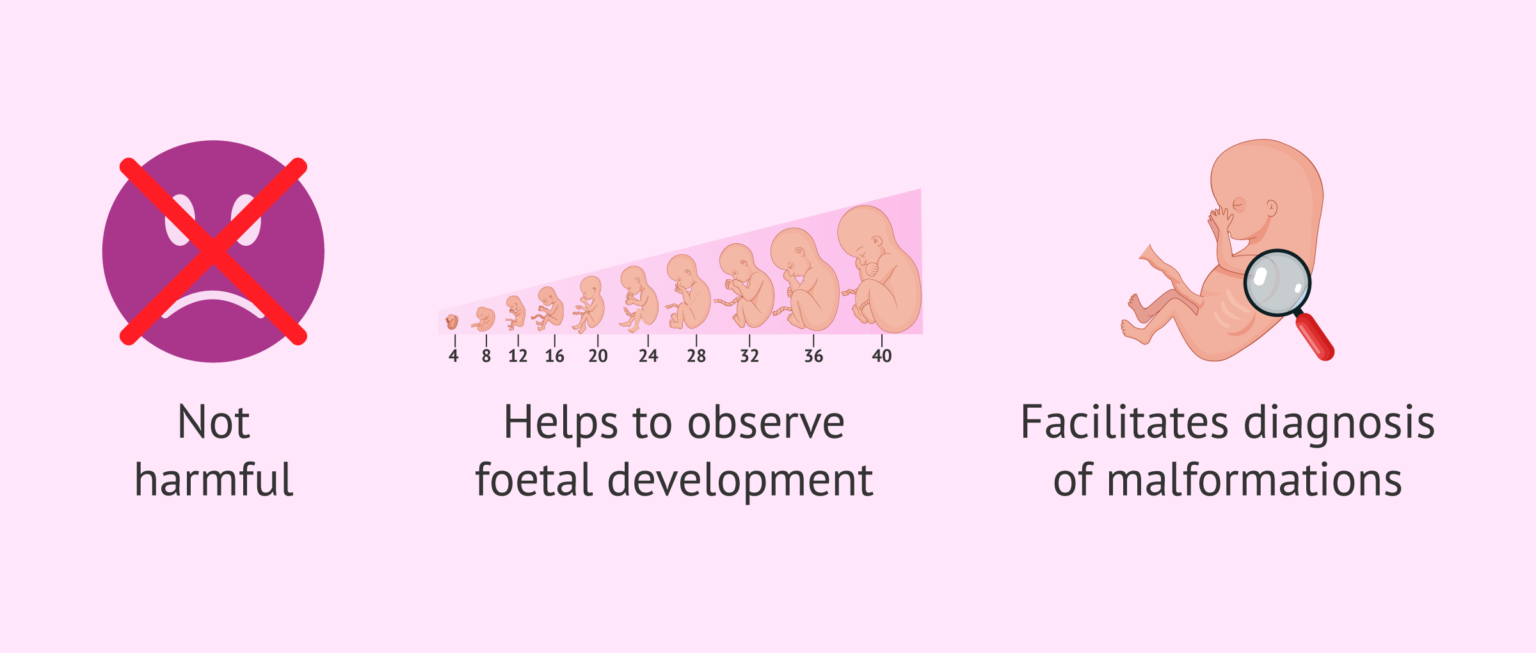 3D ultrasound in pregnancy: advantages and disadvantages