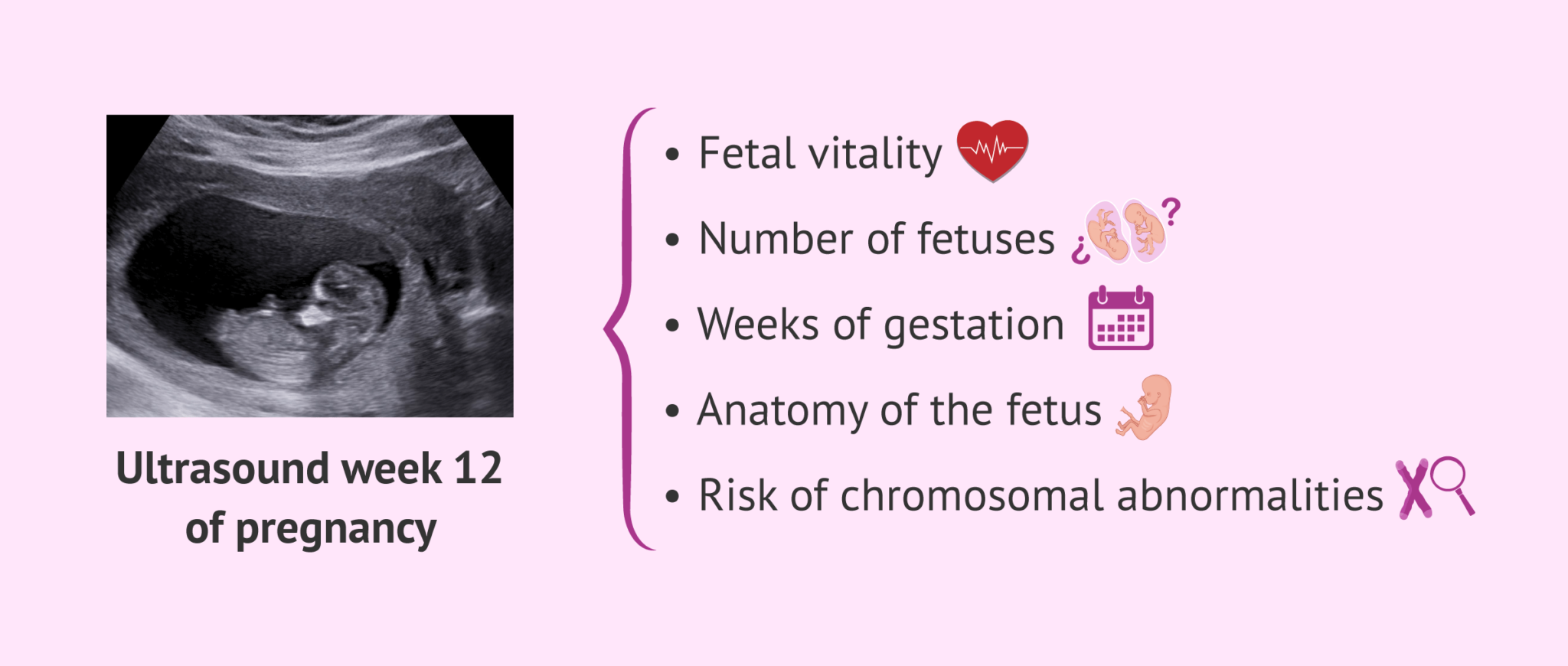 Twelfth Week of Pregnancy: the first trimester comes to an end