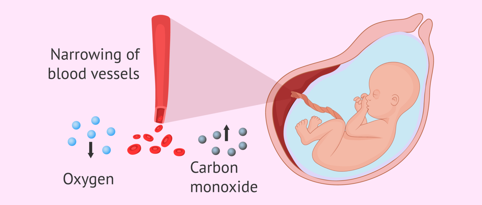 What effects does smoking during pregnancy have on the baby?