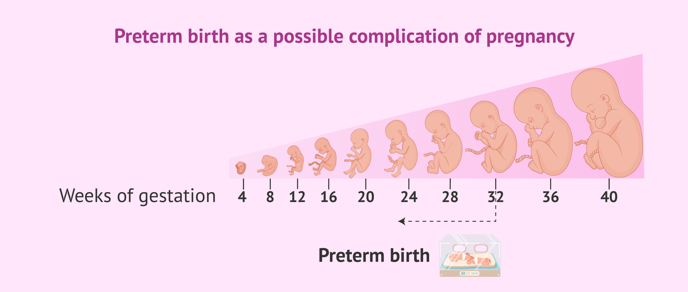 Weeks Preterm Delivery
