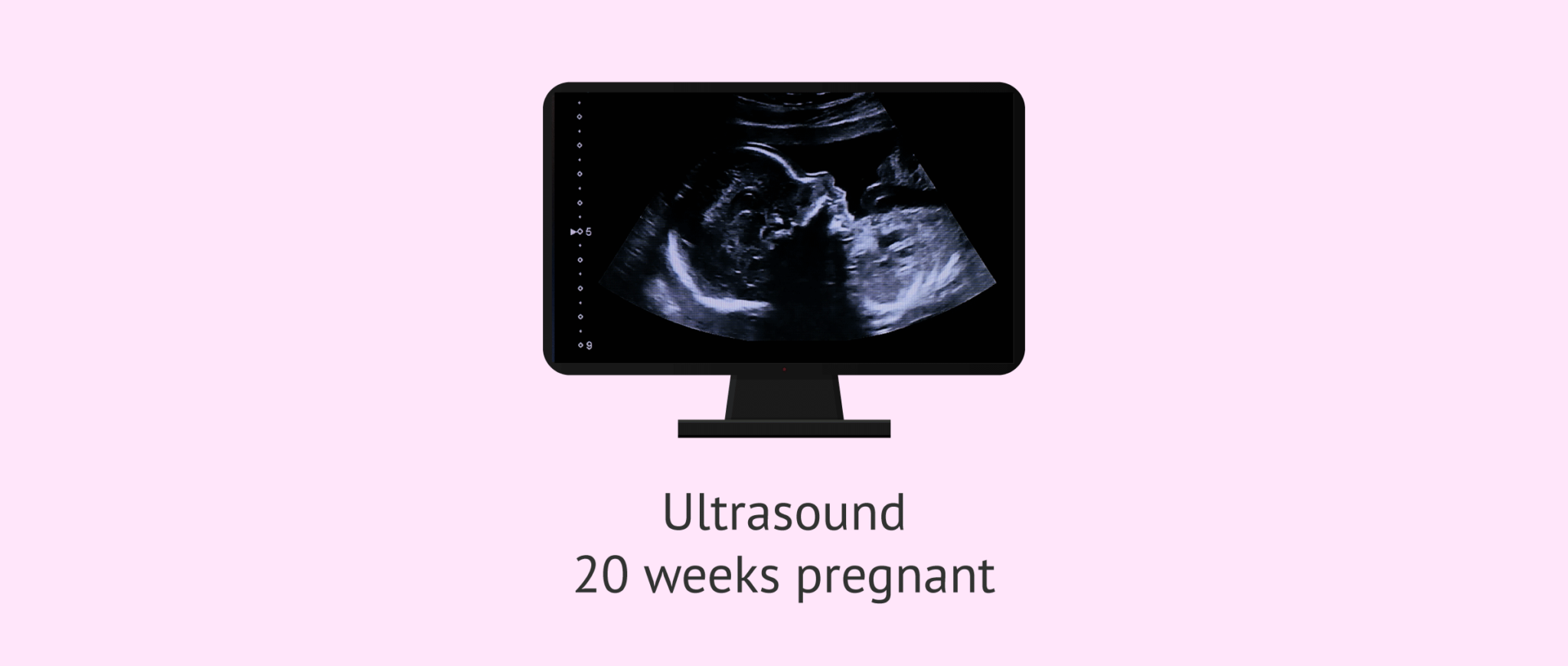 What happens to the baby and the mother in the 20th week of pregnancy?