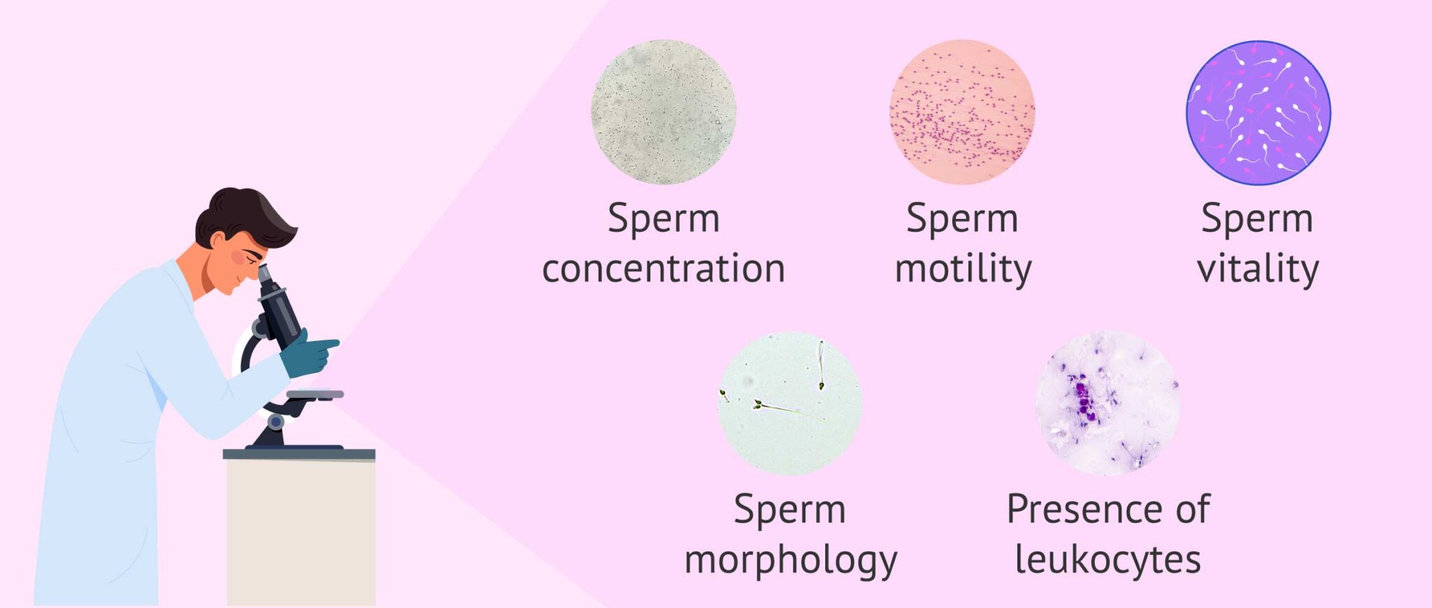 Microscopic study of a semen sample