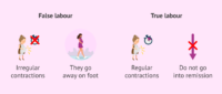 Differences between false labour and true labour