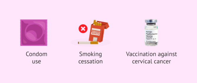 Cervical Conization: Types and Possible Complications