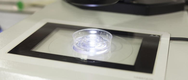 Serum IVF in vitro fertilization