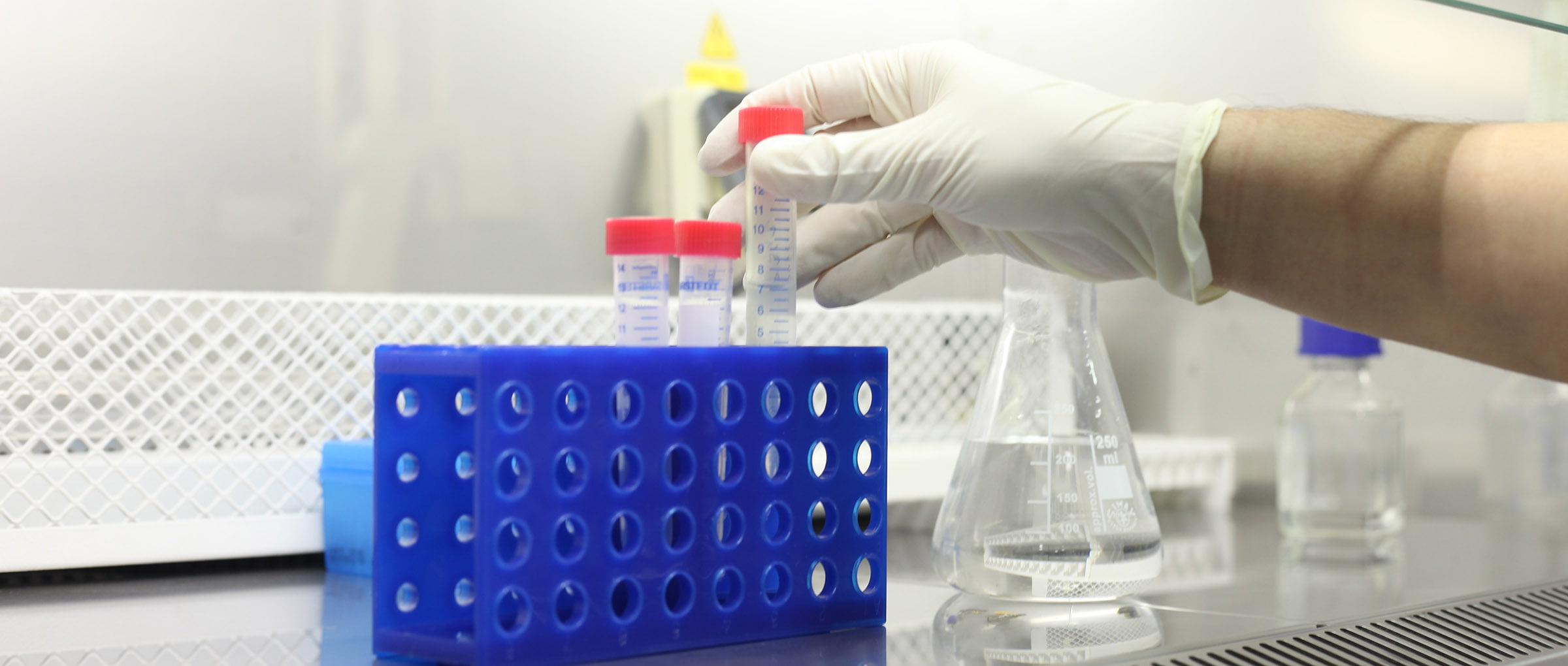 Serum IVF laboratory