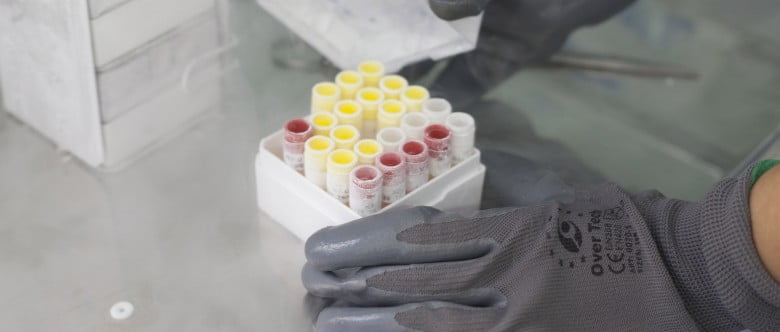 Serum IVF sperm cryopreservation