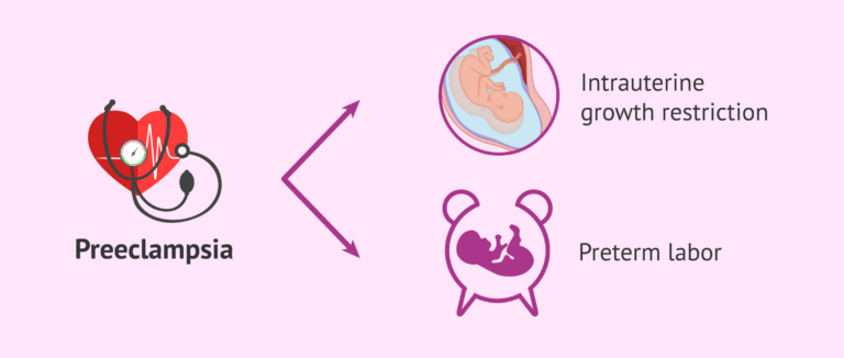 Risks of preeclampsia to the fetus