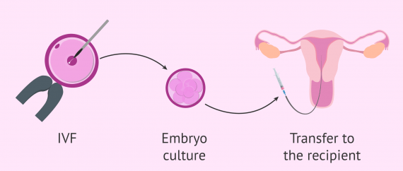 IVF treatment with donor eggs
