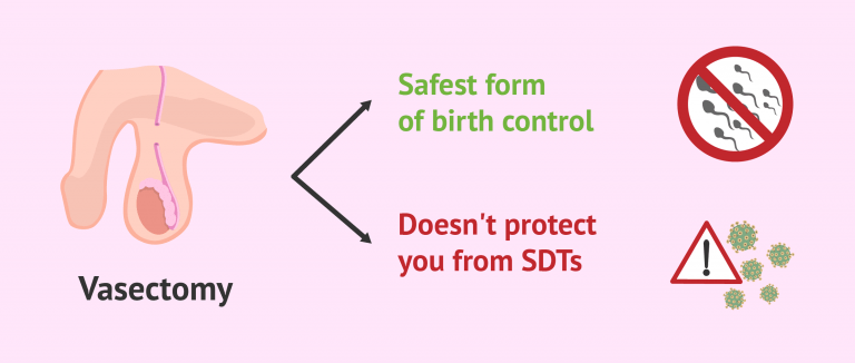 Post Vasectomy Semen Analysis How Many Tests To Confirm Sterility 0438
