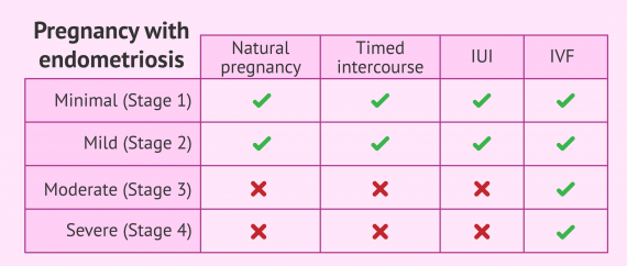 Fertility and IVF success rates after endometriosis surgery