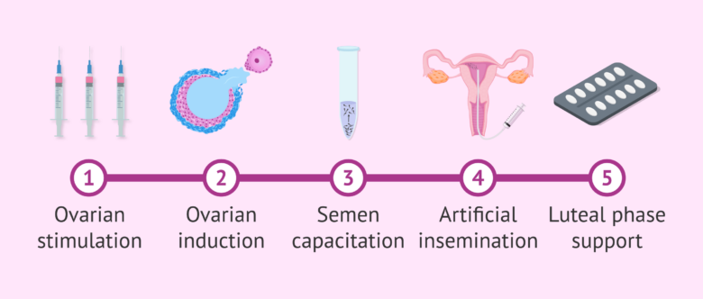 Steps In Artificial Insemination AI Treatment Steps In Artificial Insemination AI Treatment