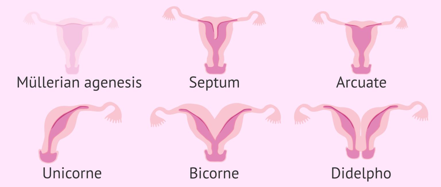 Female infertility due to uterine factor: causes and treatment