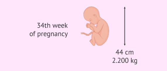 Fetus at 34 weeks of pregnancy