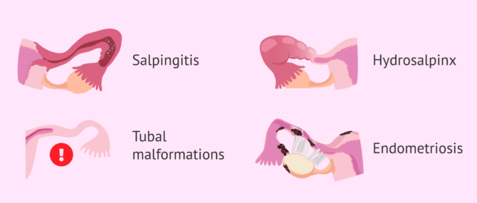 What are the main causes of sterility and infertility?