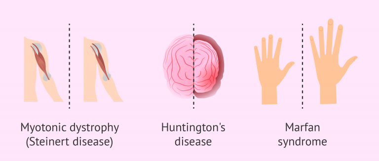 Common autosomal dominant genetic diseases