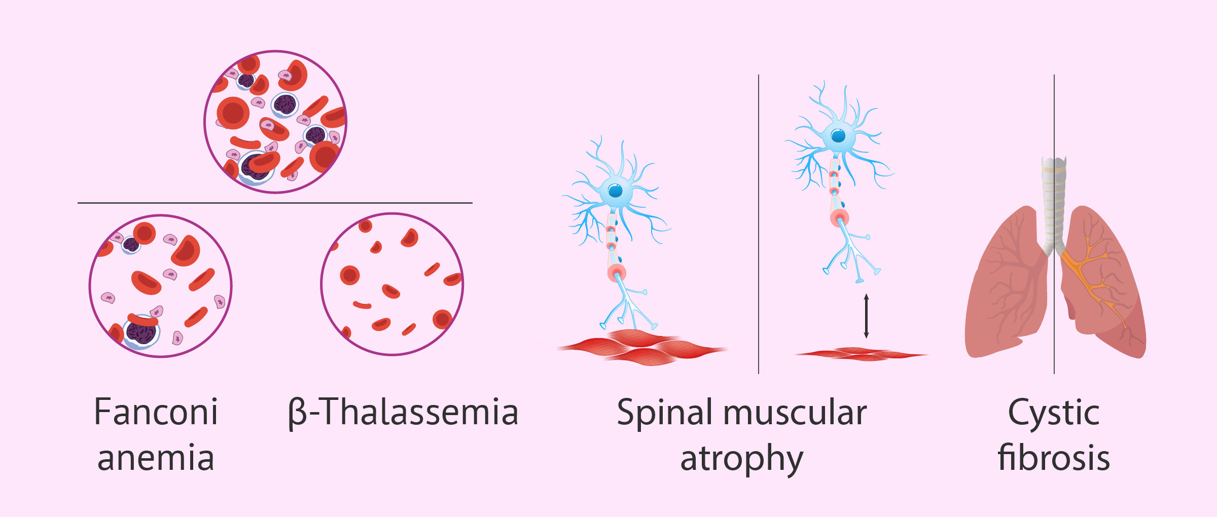What Are Monogenic Disorders? - Classification & Most Common Types What Are Monogenic Disorders? - Classification & Most Common Types