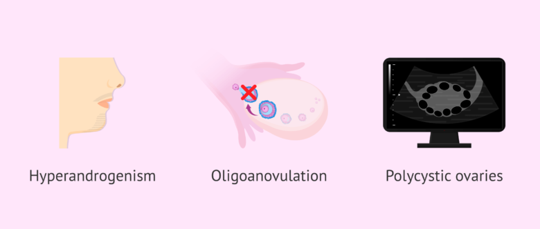 What is the difference between polycystic ovary and PCOS?