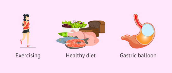 Lifestyle modifications for PCOS