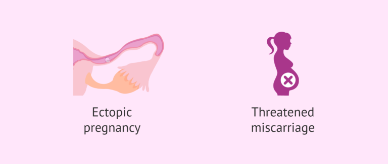The Sixth Week Pregnancy: Embryo Evolution and Symptoms