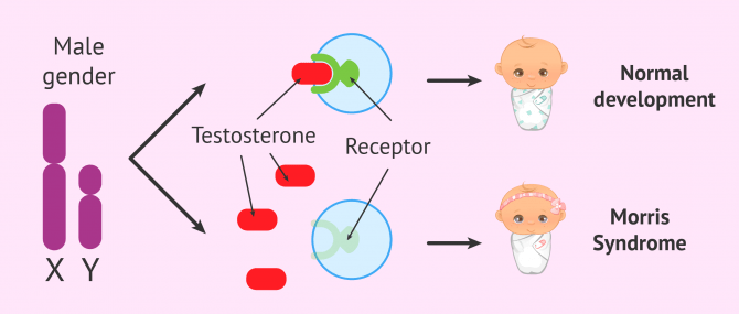 What is Morris Syndrome? - Causes, Symptoms, and Treatments