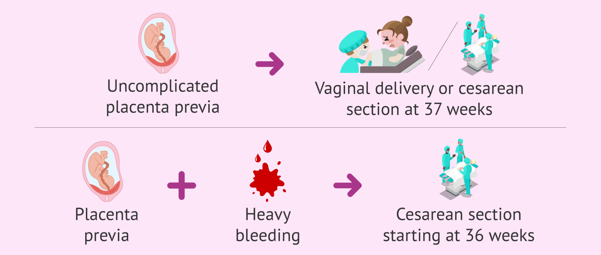 What Is Placenta Previa? Causes, Diagnosis and Labor