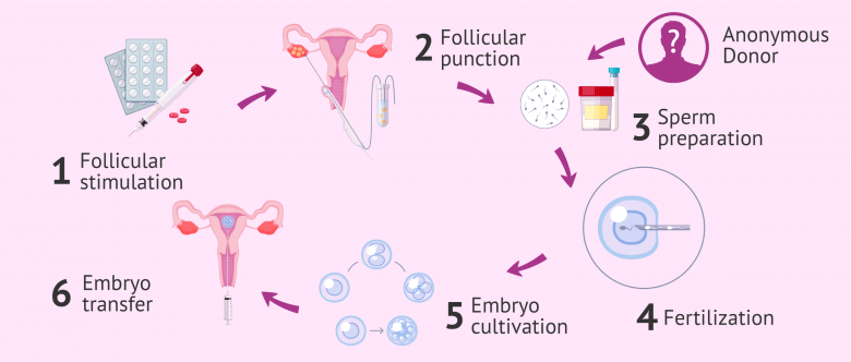 In vitro fertilization for single mothers