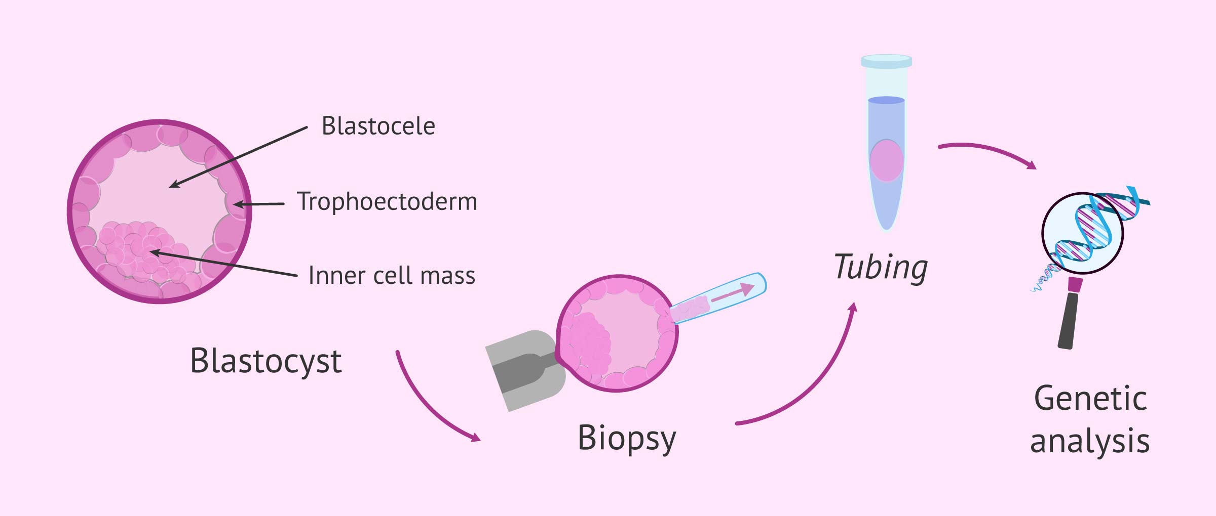 What is embryo biopsy and how is it done step by step?
