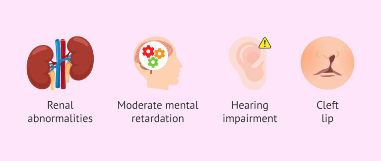 Kallmann Syndrome (KS) - Symptoms, Causes & Treatment