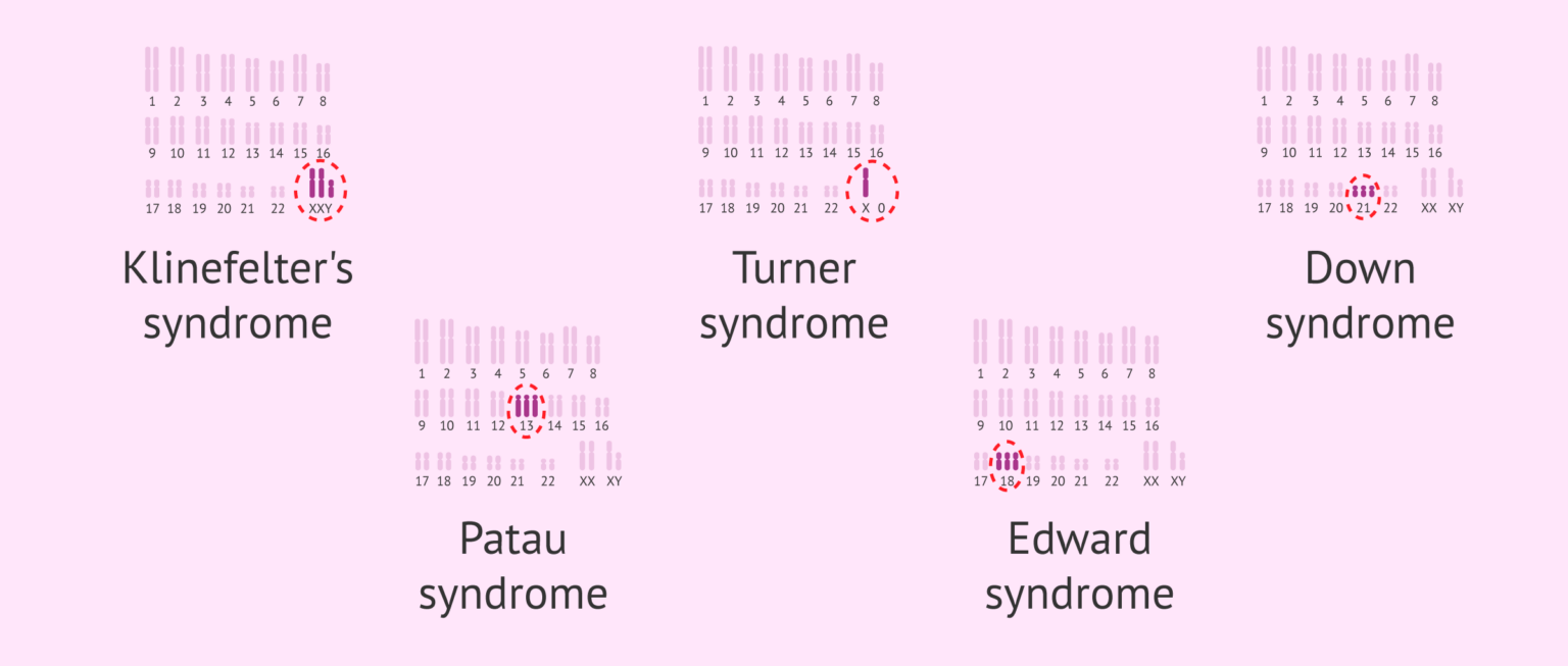 What is karyotyping and how does it affect fertility?