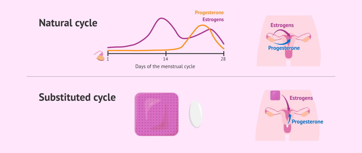 Types of endometrial preparation for frozen embryo transfer