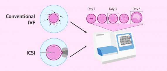 What Is EmbryoScope? - Use in IVF